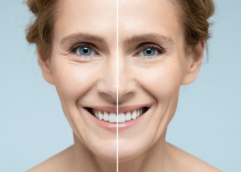 How to Tighten Loose Skin Without Surgery - Éternité Medical Aesthetics ...